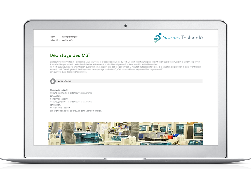 Test IST à domicile : rapide, fiable et 100 % confidentiel ...