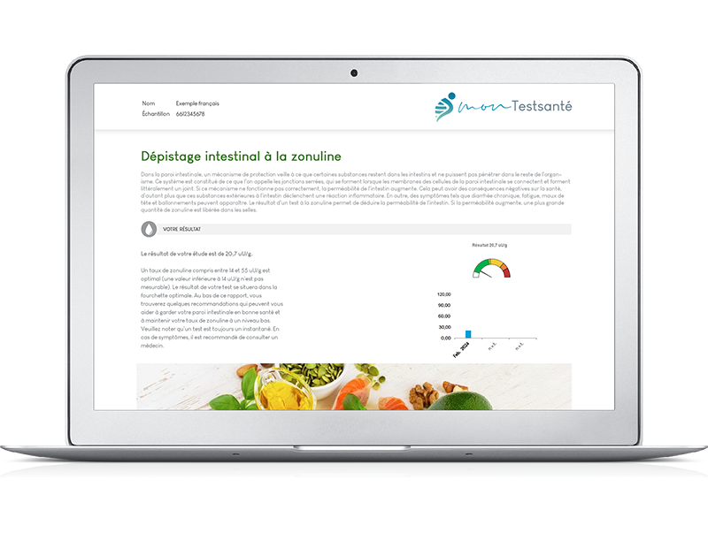 Test de la zonuline - vérifiez si l'intestin fuit - Montestsante.fr